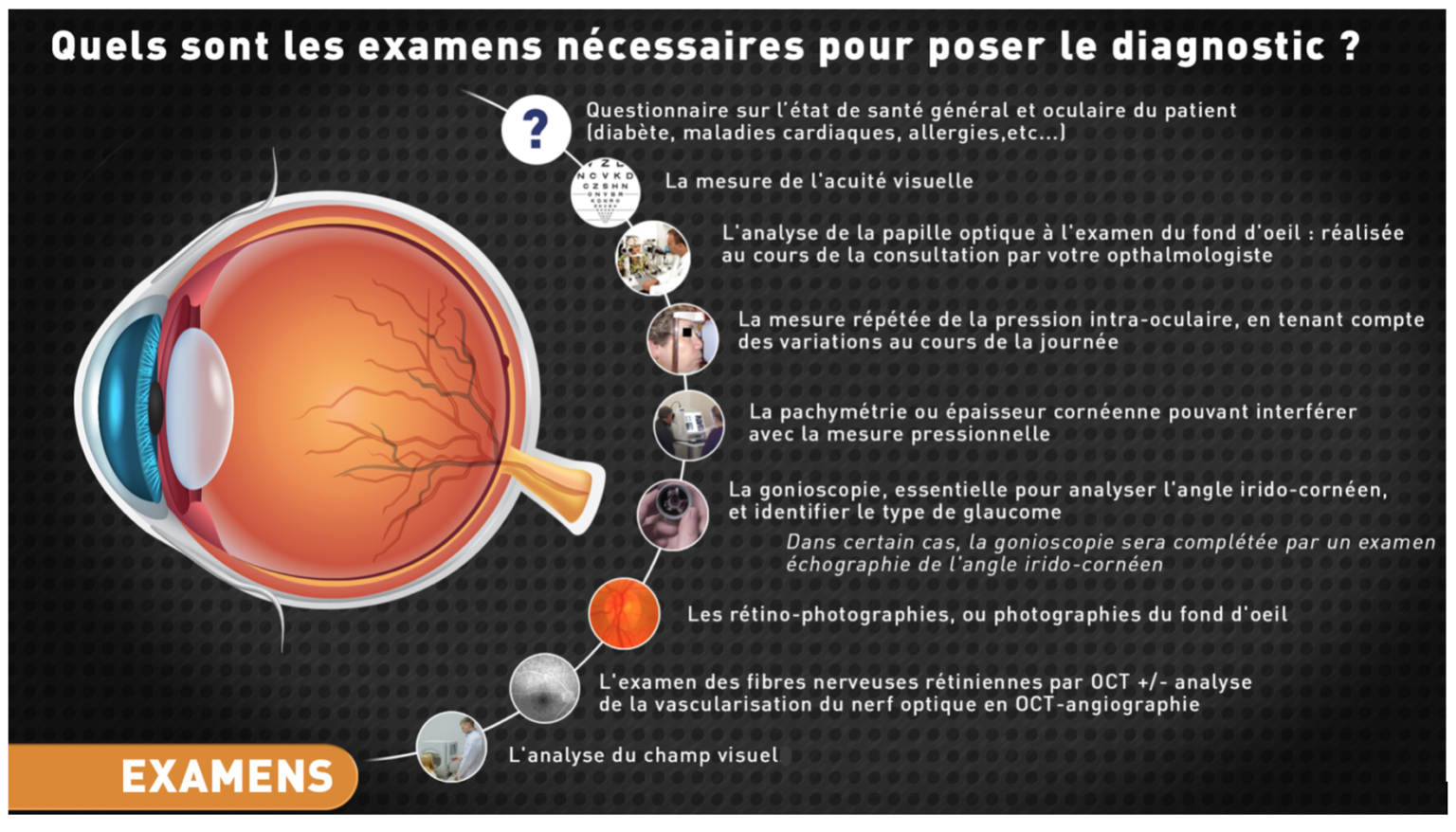 Le glaucome - Chirurgie Ophtalmologie Paris | Dr Blumen Ohana