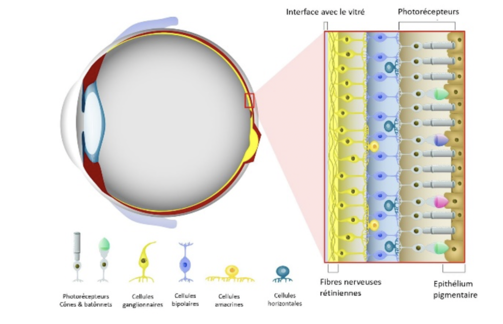 Le décollement de rétine - Chirurgie Ophtalmologie Paris | Dr Blumen Ohana